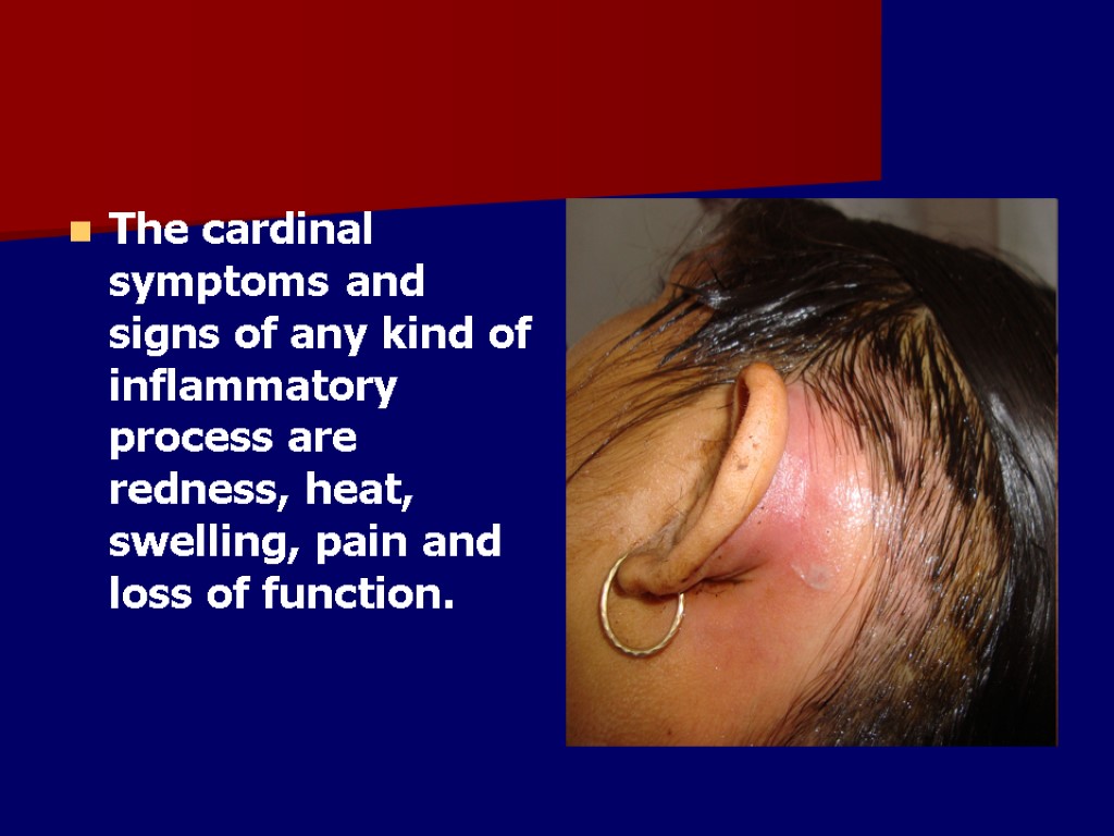 Acute purulent infections of soft tissues. A boil