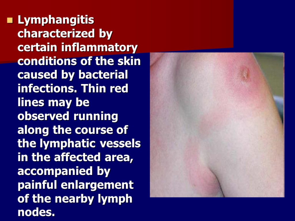 Acute purulent infections of soft tissues. A boil