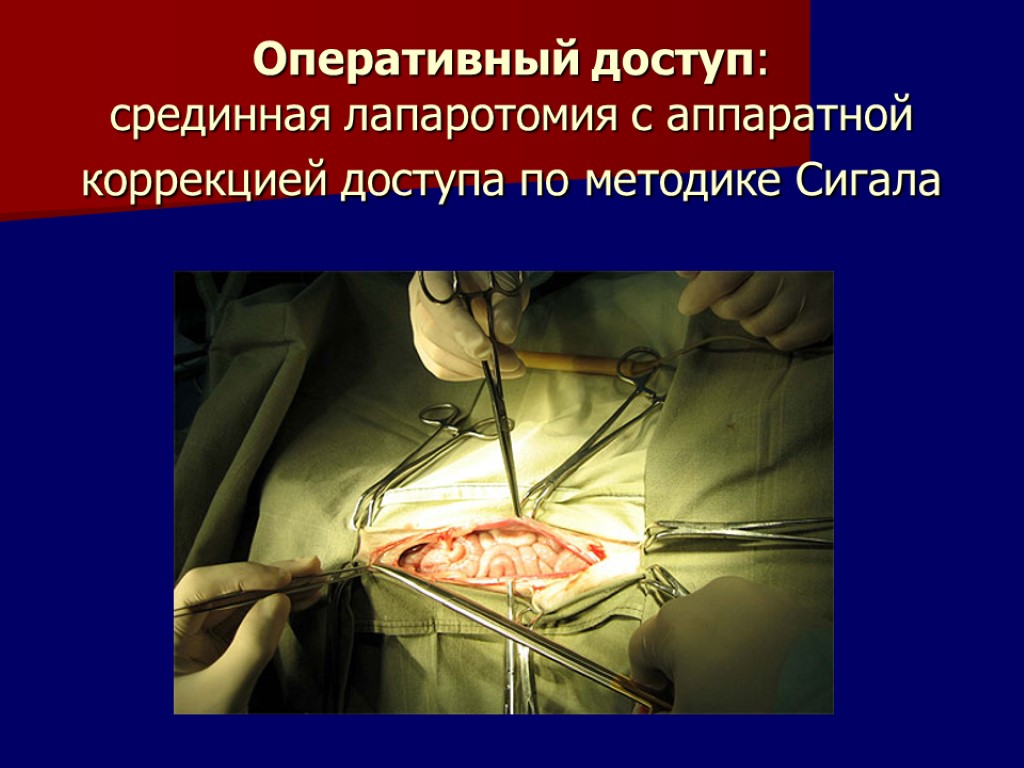 Acute purulent infections of soft tissues. A boil