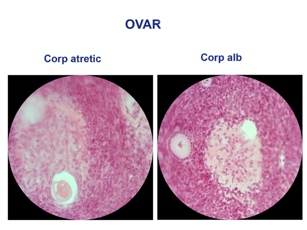 Sistemul genital feminin. Componente Organe genitale interne Ovarele