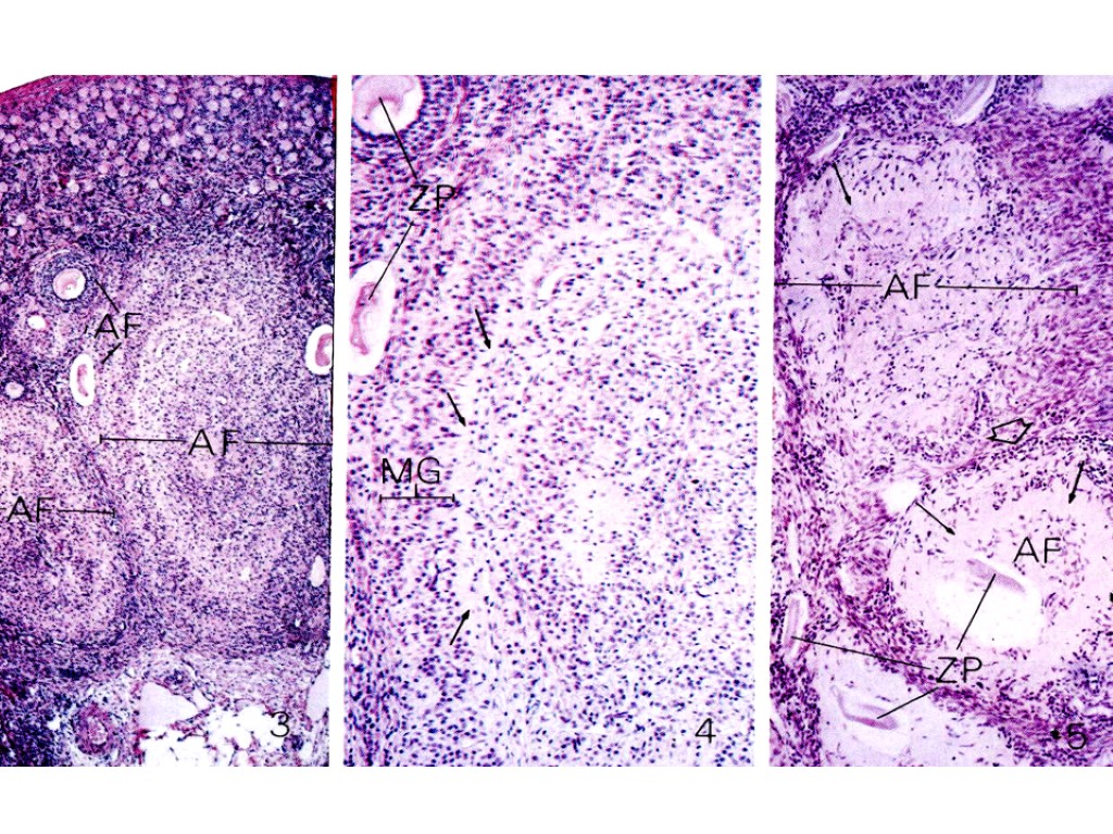 Sistemul genital feminin. Componente Organe genitale interne Ovarele