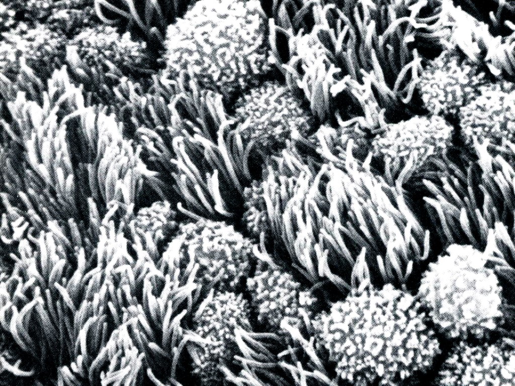 Sistemul genital feminin. Componente Organe genitale interne Ovarele