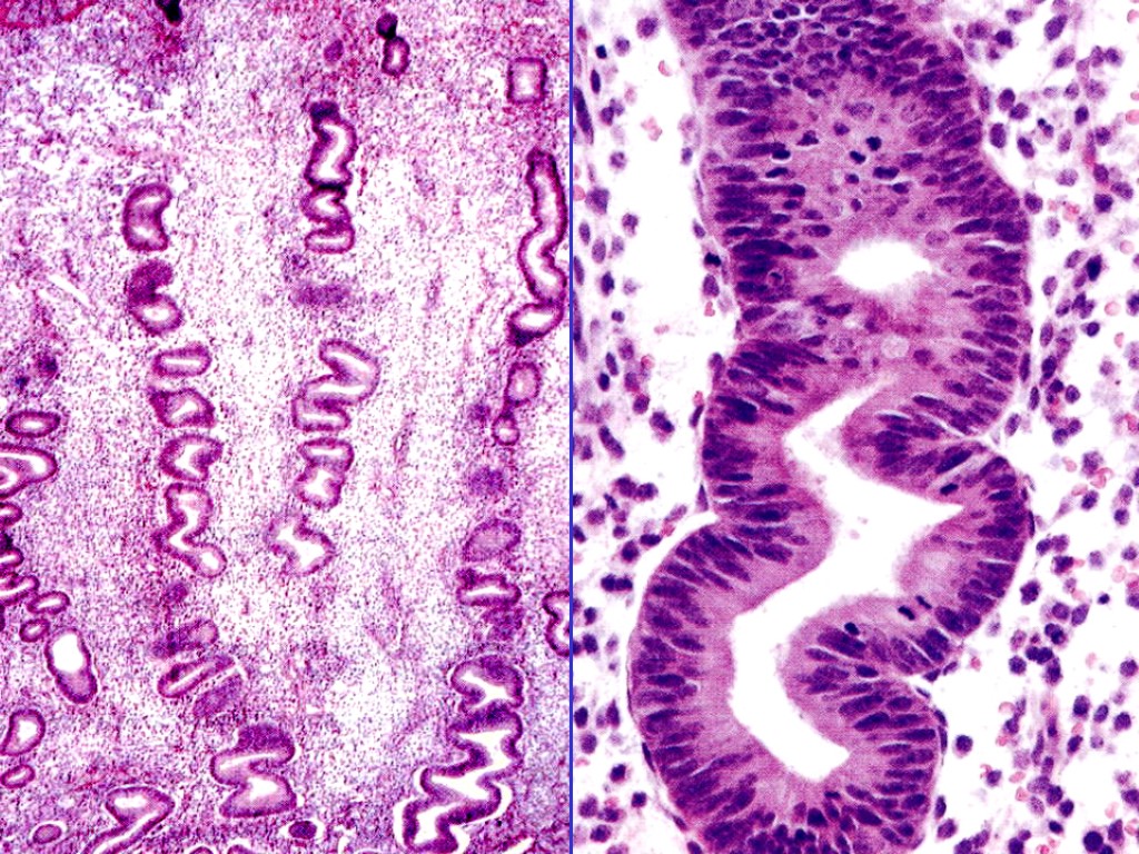 Sistemul genital feminin. Componente Organe genitale interne Ovarele