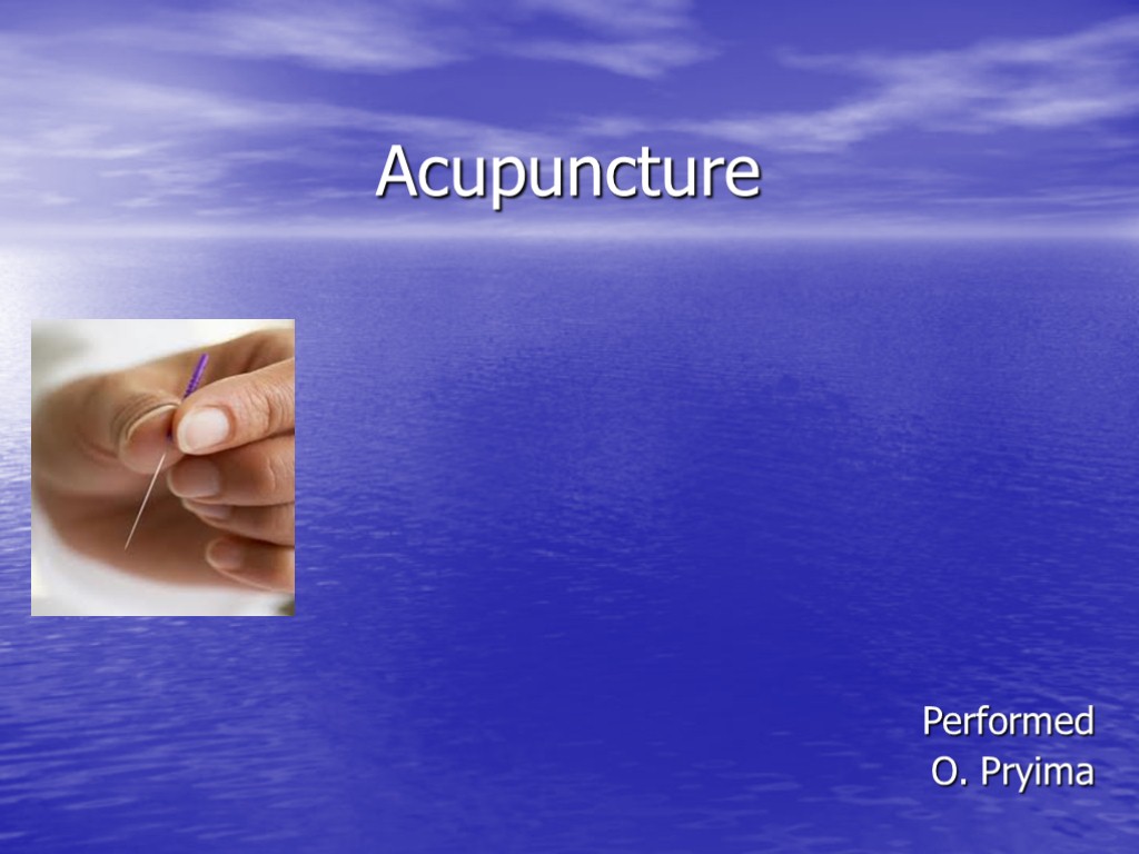 Acupuncture Performed O. Pryima. Acupuncture Acupuncture—treatment by ...