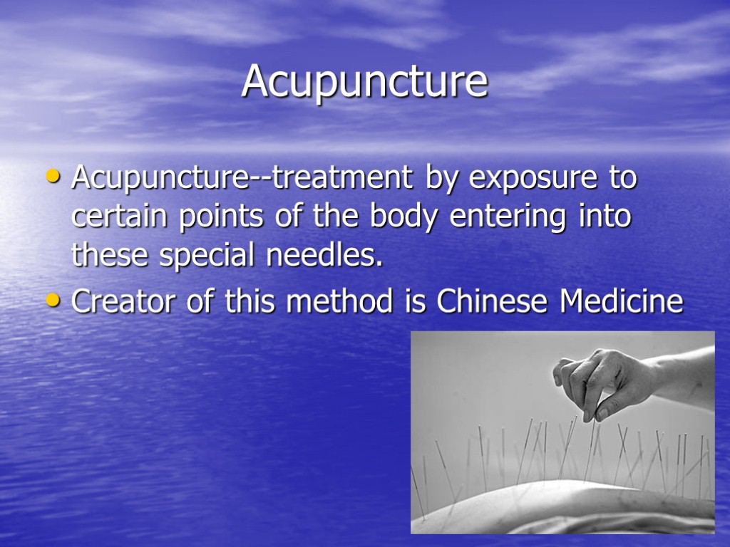 Acupuncture Performed O. Pryima. Acupuncture Acupuncture—treatment by ...