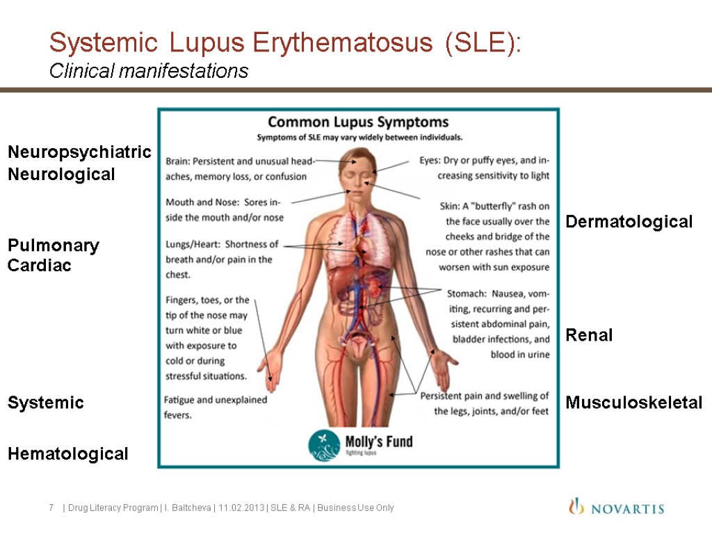 Irina Baltcheva February 11 th, 2013 Treating autoimmunity: