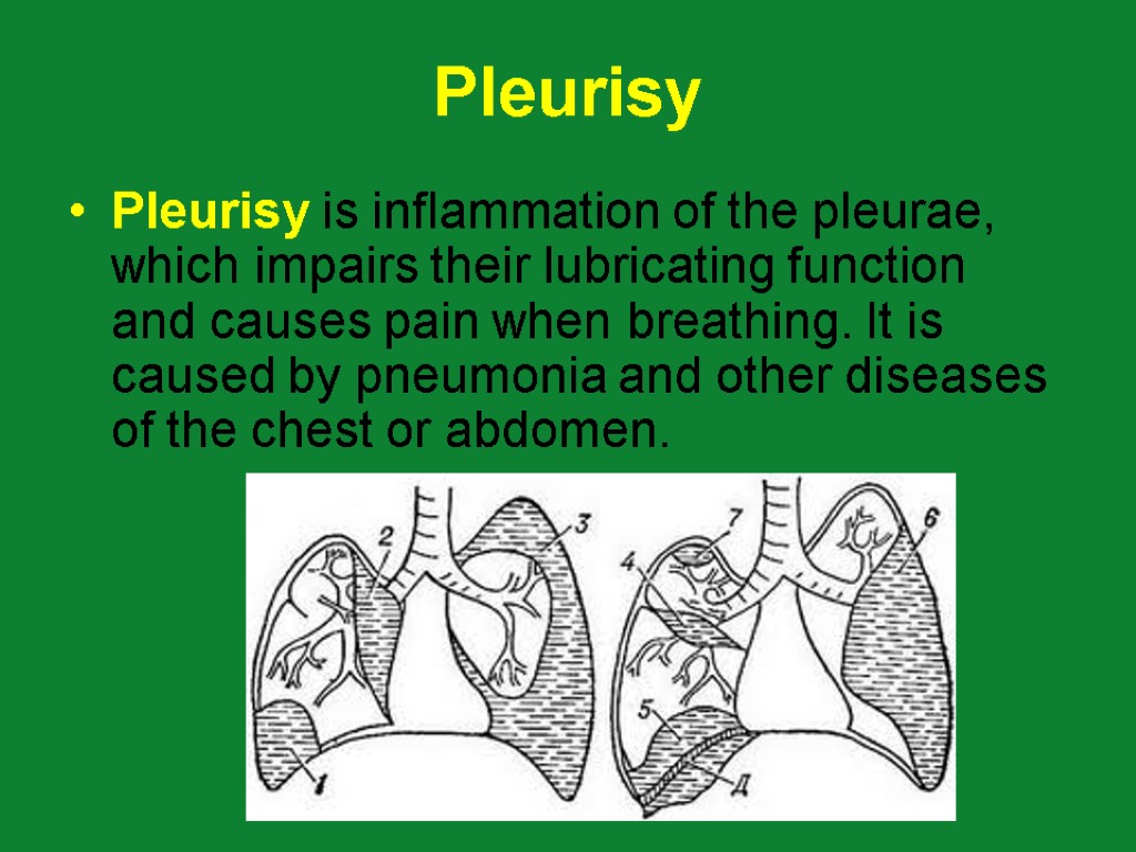 Respiratory diseases. Respiratory structures such as the airways,