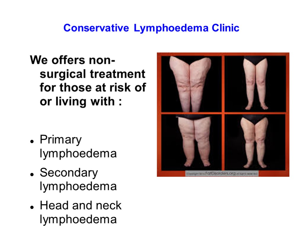 MQ Health Lymphoedema & Lymphoedema Management At MUHLymphoedema