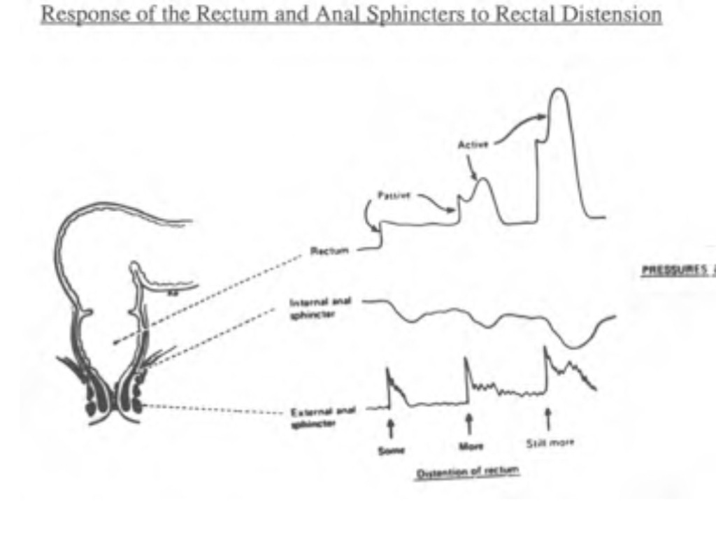 The Physiology of Human Defecation S. Palit
