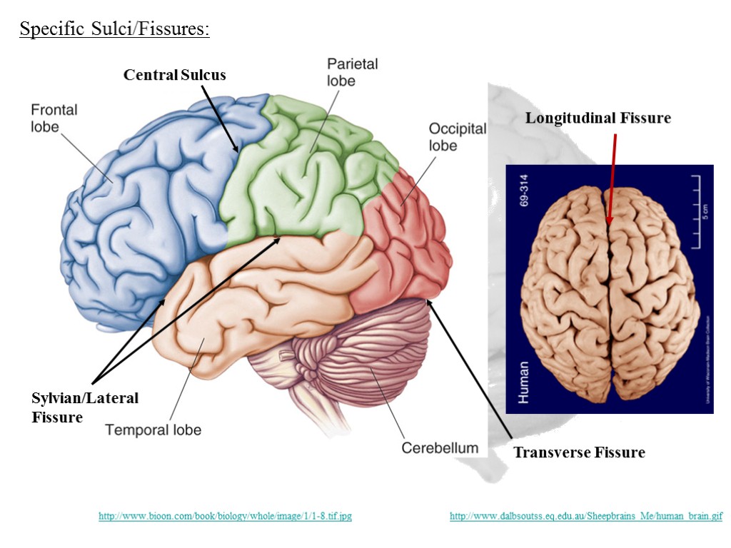 The Human Brain Master Watermark Image: http: //williamcalvin.