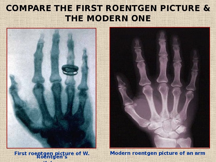 X-Rays Radiation Application in Medicine IONIZING RADIATION