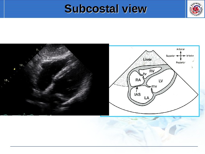 Transthoracic Echocardiography. Standard Imaging of A.