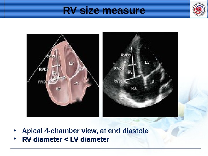 Transthoracic Echocardiography. Standard Imaging of A.