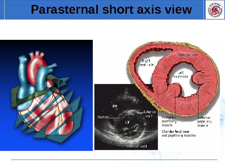 Transthoracic Echocardiography. Standard Imaging of A.