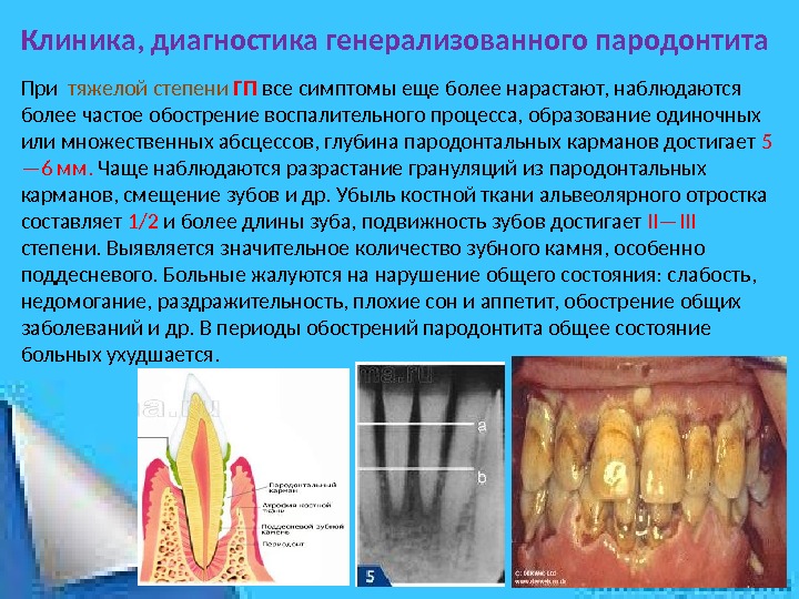 Презентация 4 курс Лекция 3 Этиологи патог. п-та А.Бас