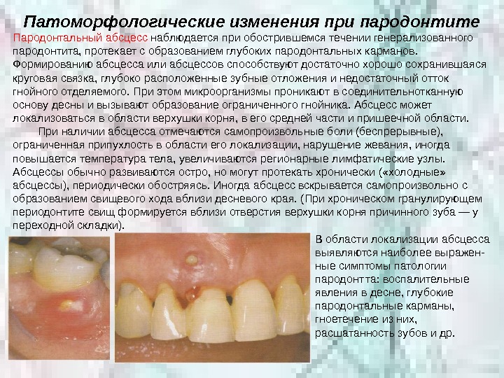Презентация 4 курс Лекция 3 Этиологи патог. п-та А.Бас