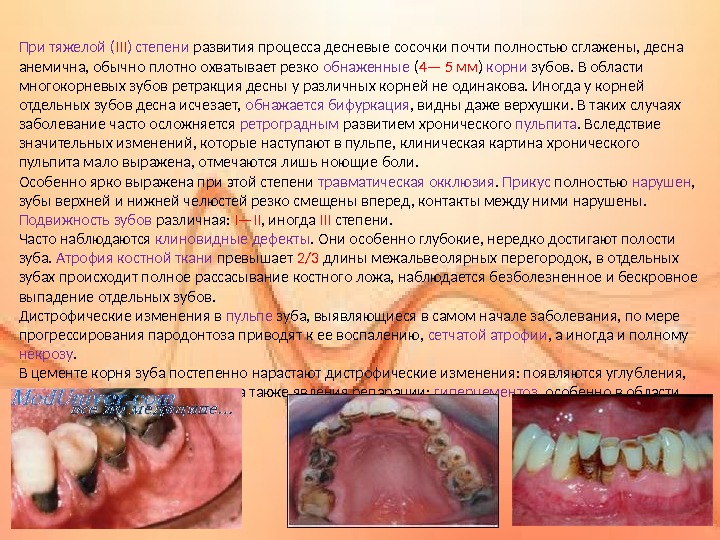 Презентация 4 курс Лекция 3 Этиологи патог. п-та А.Бас