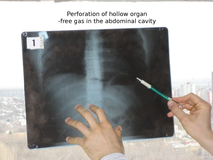 6 th year final exam’s x-ray pictures