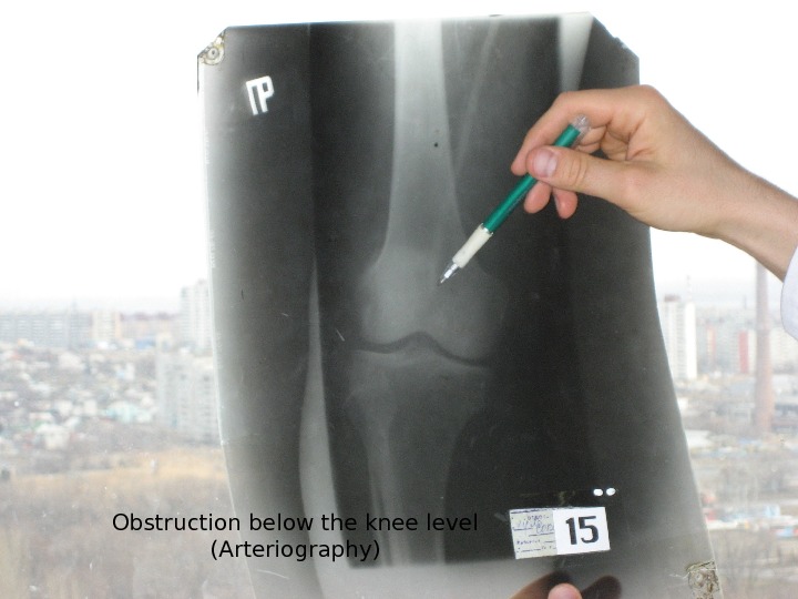 6 th year final exam’s x-ray pictures