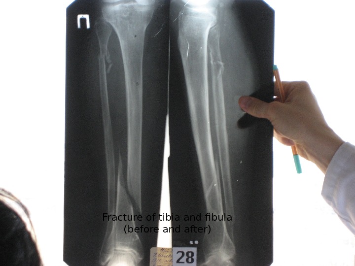 6 th year final exam’s x-ray pictures