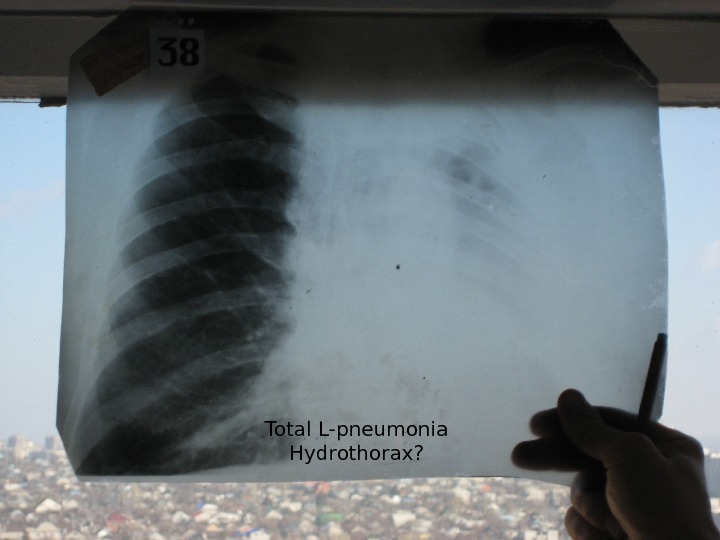 6 th year final exam’s x-ray pictures