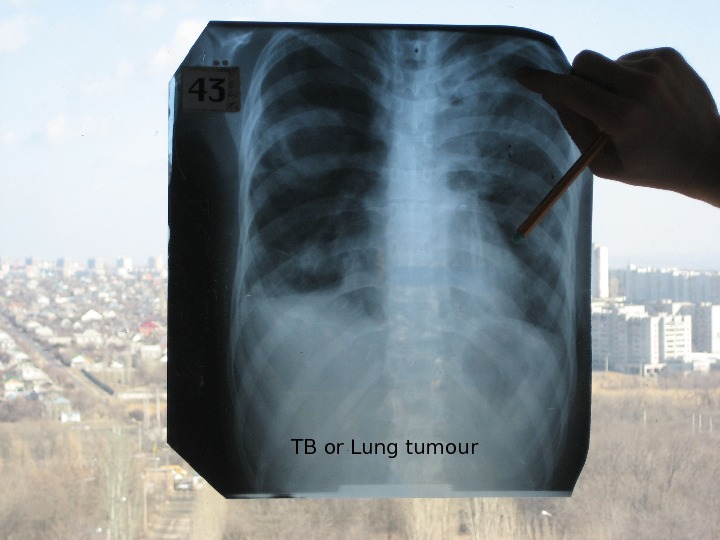 6 th year final exam’s x-ray pictures