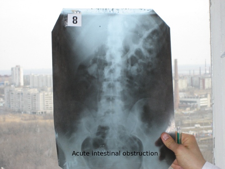 6 th year final exam’s x-ray pictures