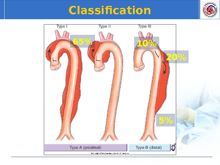Aortic & Systemic Disease Classification 65% 20%10%