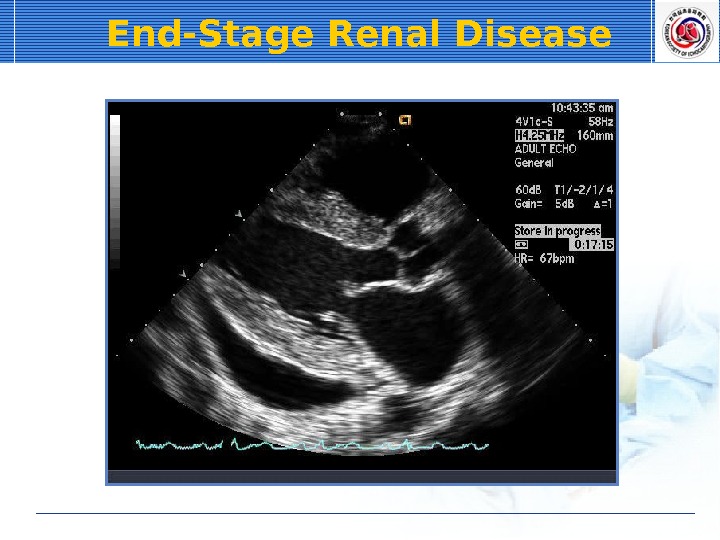 Aortic & Systemic Disease Classification 65% 20%10%