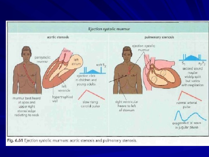 Презентация auscultation heart