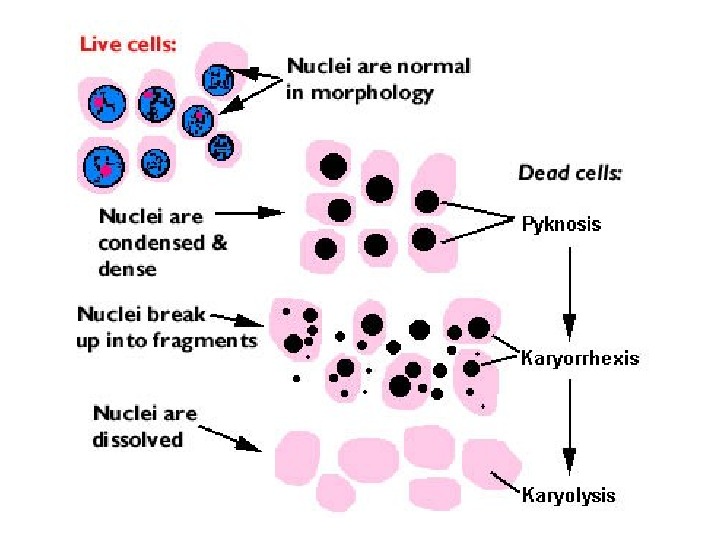 Cell Injury, Cell Death, and Adaptations Cells