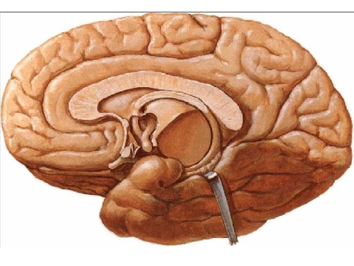 Endbrain Interbrain Midbrain Hindbrain Some types of