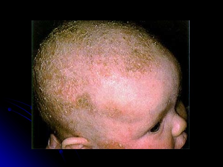 Common Pediatrics Infectious Diseases Dr. Owis khater