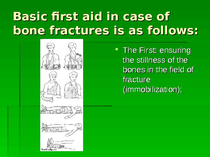 First aid in case of fractures