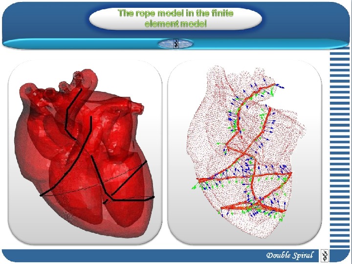 Жуковский Москва. Heart surgical simulator Gerald D.