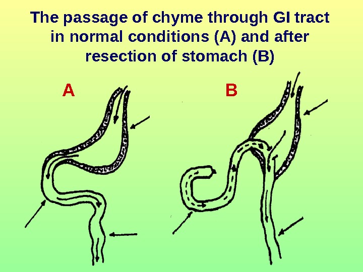Pathophysiology of gastro-intestinal tract Gastro-intestinal tract