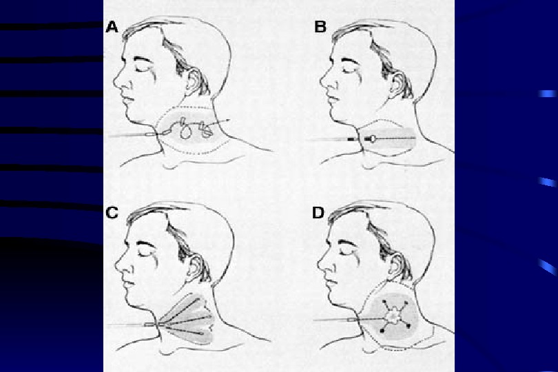 Penetrating Neck Trauma Rambam Medical Center Dr Nordkin