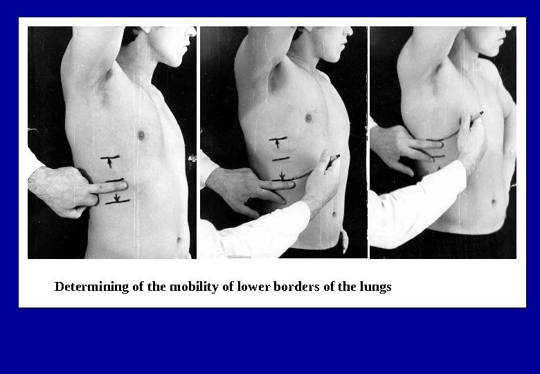 Percussion of the lungs Palpation of the chest