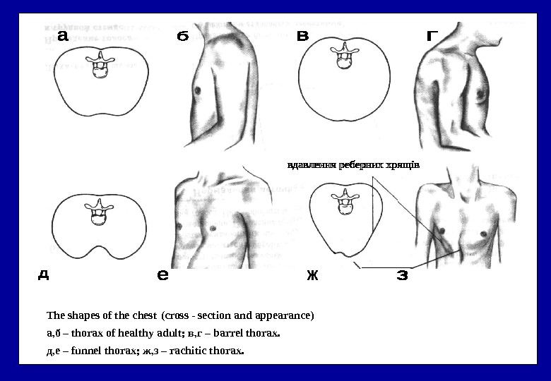 Percussion of the lungs Palpation of the chest