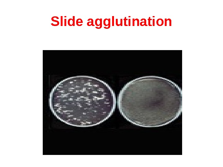 Agglutination and Precipitation Reactions Antigen An