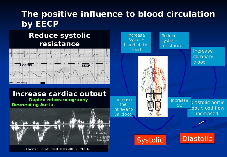 Enhanced External Counterpulsation