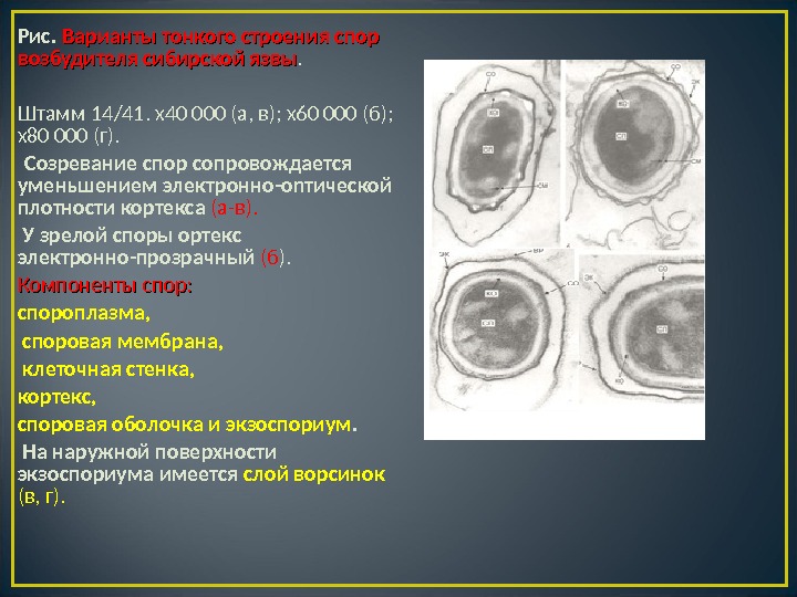 Презентация sib yazva finish