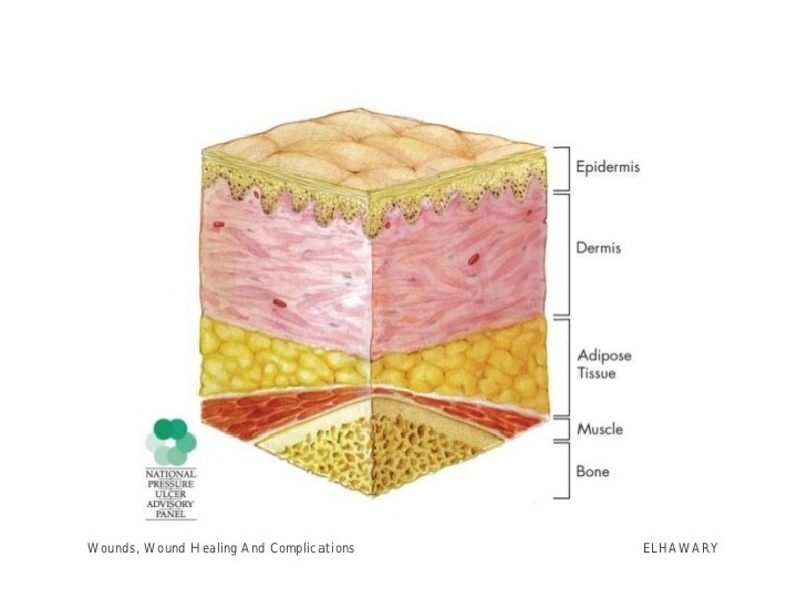 Презентация wounds. wounds healing amp complications