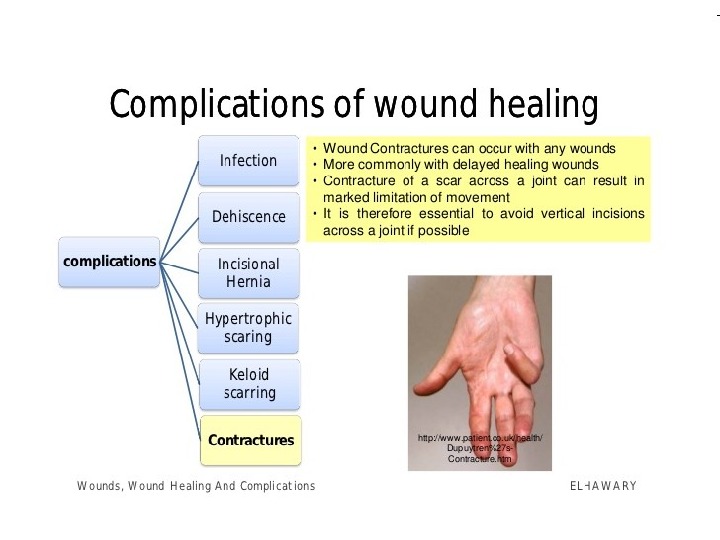 Презентация wounds. wounds healing amp complications