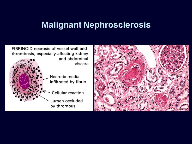 RENAL PATHOLOGY Greg Balko, MD May 27, 2009