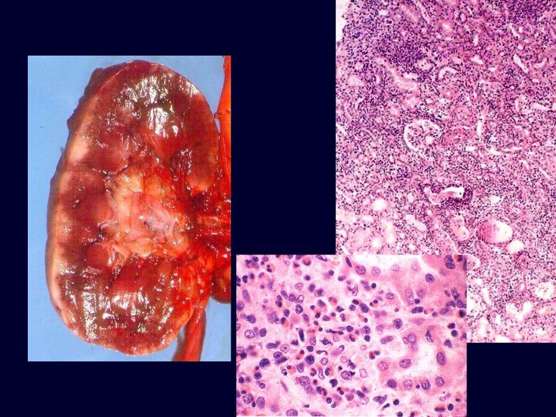 RENAL PATHOLOGY Greg Balko, MD May 27, 2009