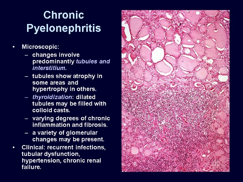 RENAL PATHOLOGY Greg Balko, MD May 27, 2009