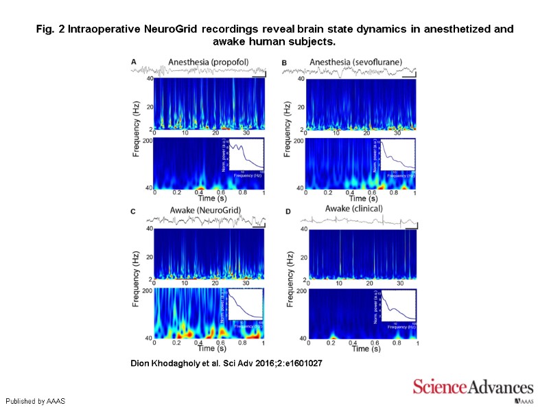 Organic electronics for high-resolution electrocorticography of the human