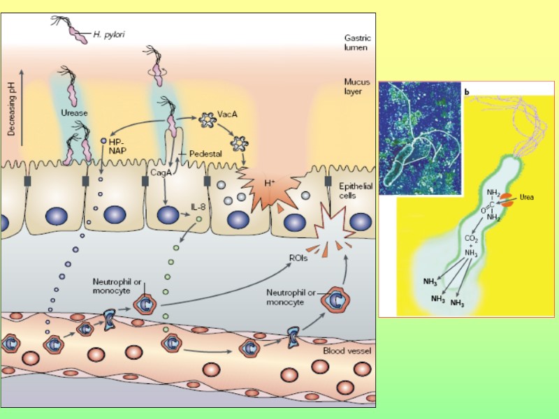 Pathophysiology of gastro-intestinal tract Gastro-intestinal tract ...