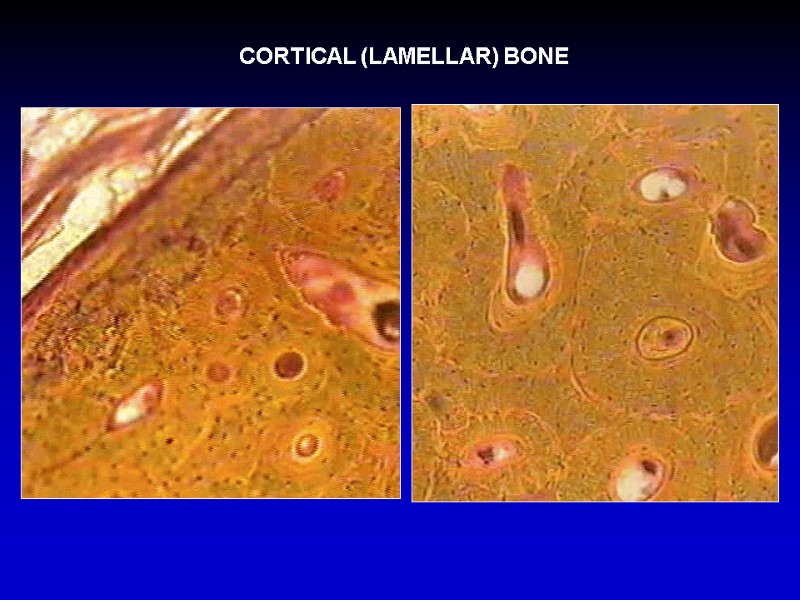 STRUCTURE, DEVELOPMENT AND REGENERATION OF BONE TISSUE CLASSIFICATION